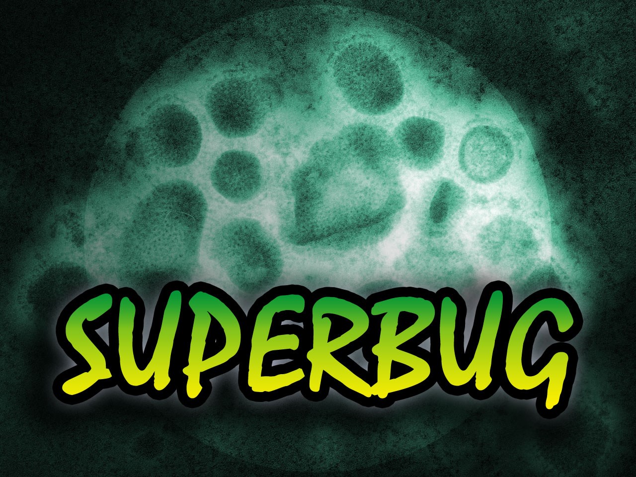 'Nightmare Bacteria' Superbug Found for First Time in US | kcentv.com